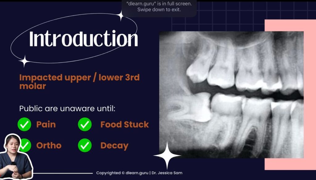 Dlearn Dental | Online Masterclasses - Dlearn