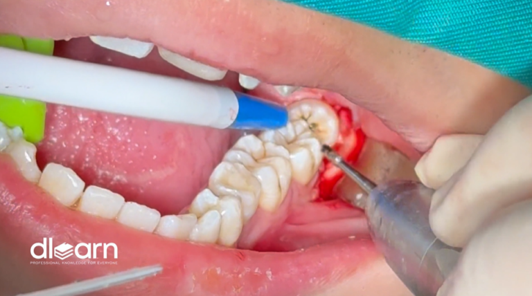 Dlearn Dental | Online Masterclasses - Dlearn